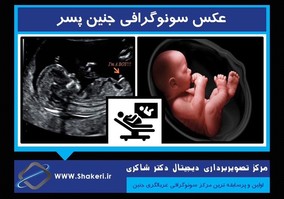 عکس سونوگرافی جنین پسر مرکز تصویربرداری دکتر شاکری